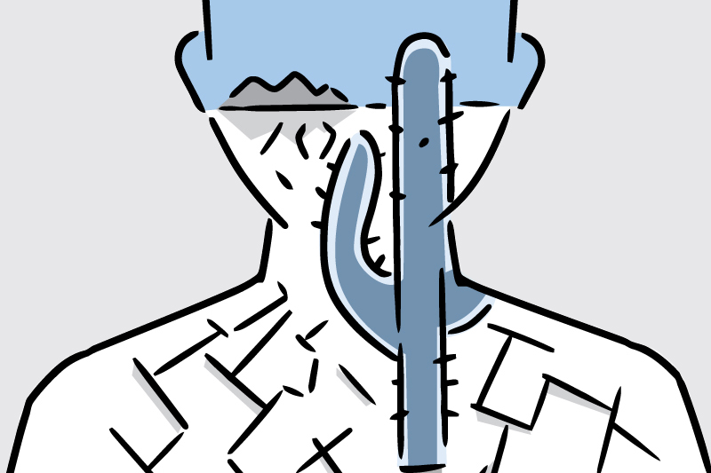 Dry Eyes and Mouth? | NIH News in Health