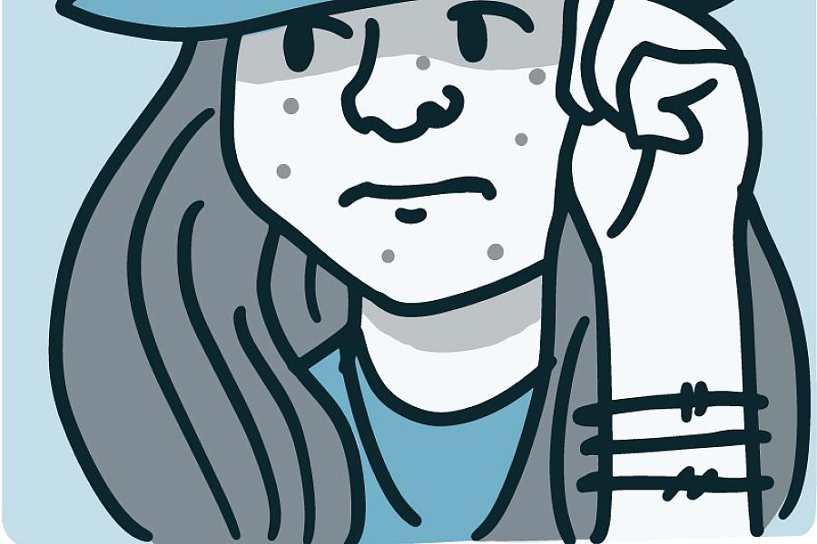 Acne Breakouts | NIH News in Health